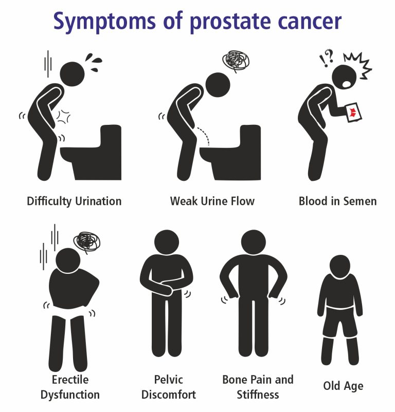 Prostate Cancer: Symptoms, Treatment and Diagnosis - Vijaya Diagnostic