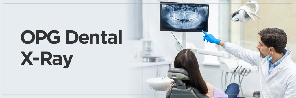OPG Dental X-Ray: Why It's Done, How It Works & Results