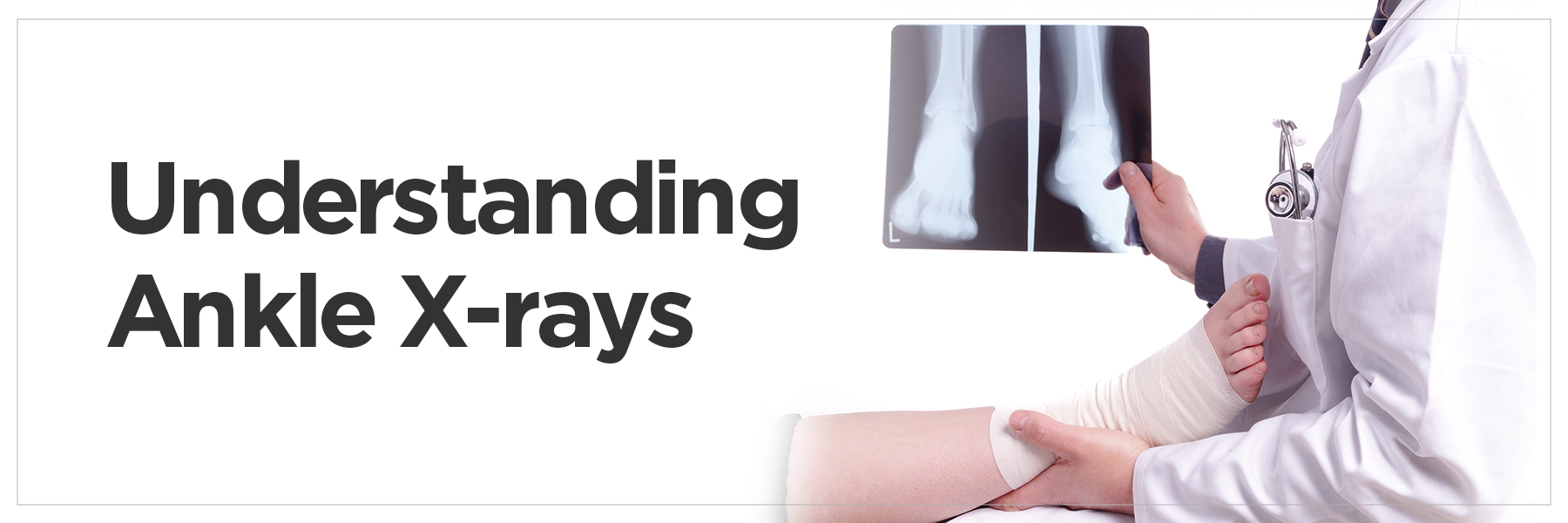 X-Ray Ankle AP & Lateral View: Purpose, Procedure & Cost