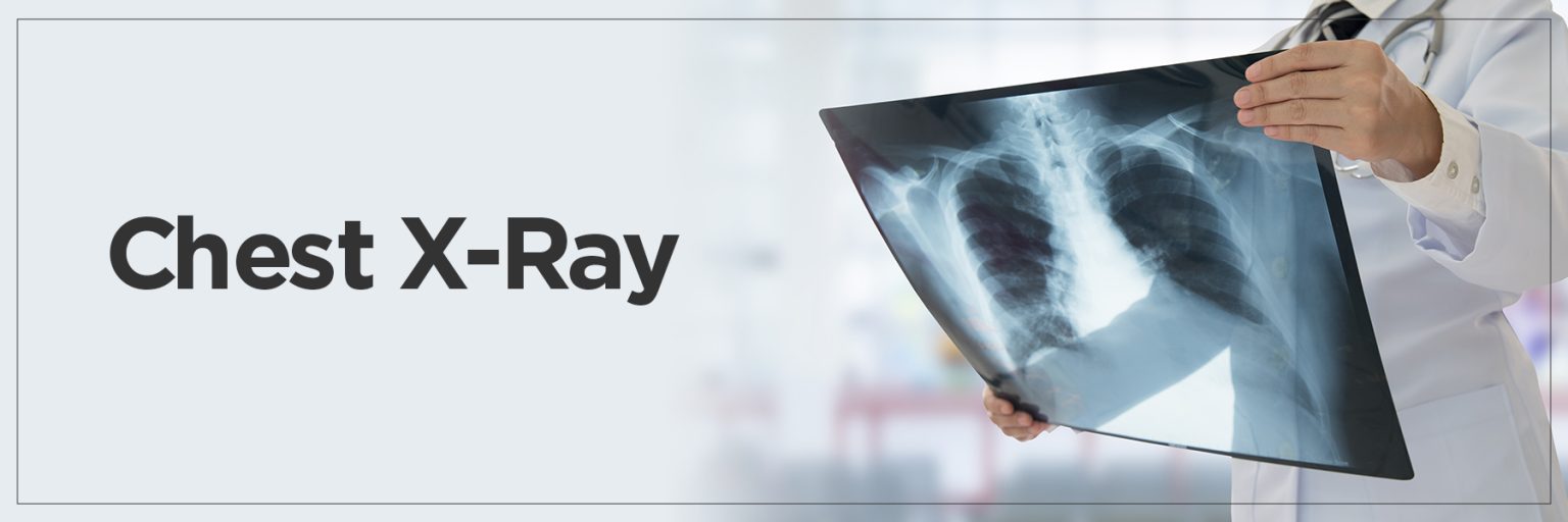 Chest X-Ray: Why It’s Done, How It Works, and Risks