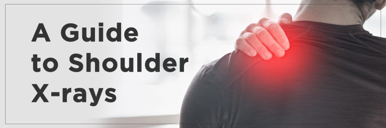 Understanding Shoulder X-rays: How They Diagnose, Prepare, and ...