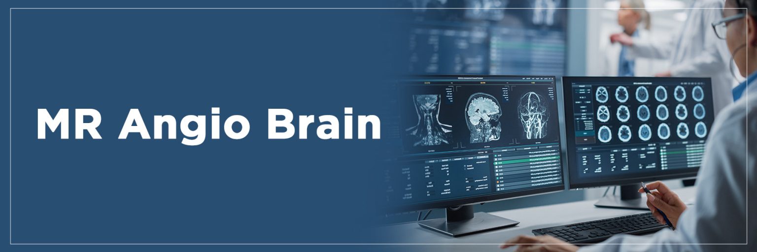 MR Angio Brain: How It Works, Benefits, and Safety Explained